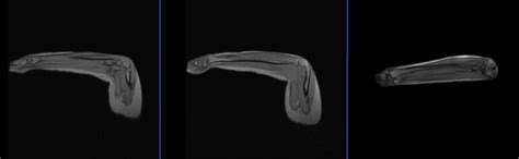 Mri Fabs View Fabs View Protocol And Planning