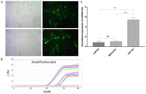 Microrna‑34a Inhibits Metastasis In Liver Cancer Cells