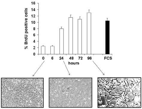 Tgf β 1 Induction Of Endothelial Cell Proliferation And Capillary