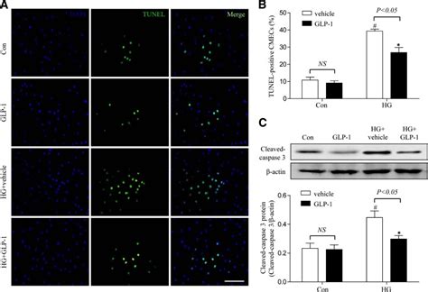 GLP 1 Exerted Antiapoptotic Effect On High Glucoseinduced CMECs A