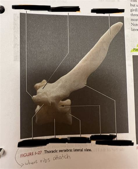 Thoracic Vertebra Lateral View Diagram Quizlet