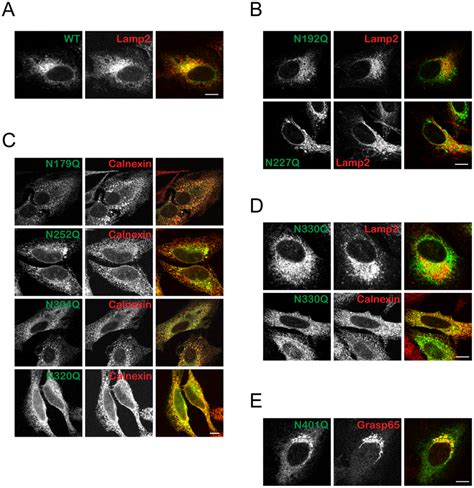 Subcellular Localization Of Cln5 N Glycosylation Mutants Confocal Download Scientific Diagram