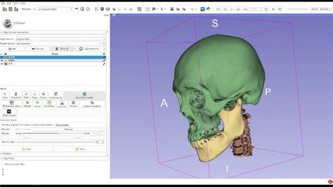 No Skull Segmentation Task In Slicer · Issue 227 · Wasserth