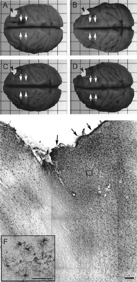 General Observations Of Re Implanted Monkey Brains Ad Macroscopic