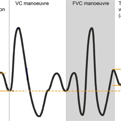Spirogram Of Lung Volume Changes During The Examination Four Phases Download Scientific