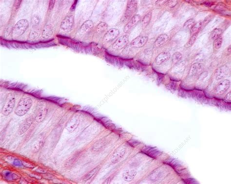 Simple Columnar Epithelium Nonciliated