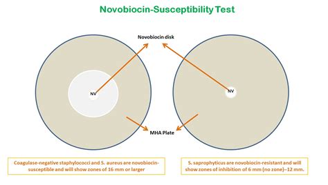 Novobiocin Susceptibility Test Principle Procedure And Results