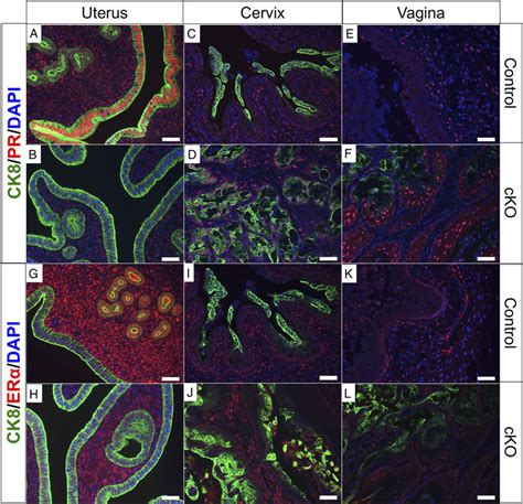Estrogen Receptor α And Progesterone Receptor Immunostaining
