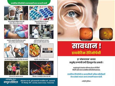 Diabetic Retinopathy