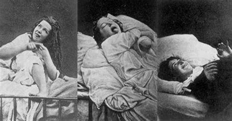 Strange Diseases That Science Never Explained