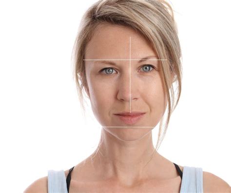 Facial Asymmetry Belmont Medical