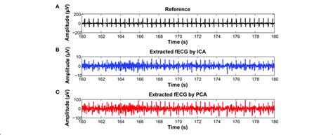Examples Of The Signals Producing Unsatisfactory Results In FHR