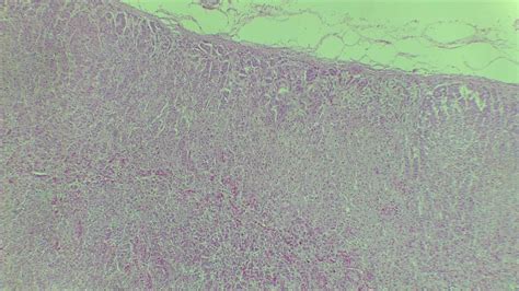 Adrenal Gland Histology Diagram Quizlet