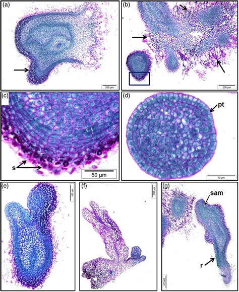 Histological Analysis Of Nodular Embryogenic Structures And Somatic Download Scientific Diagram