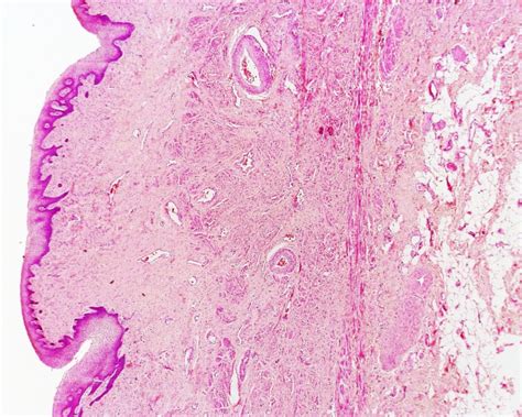 File Vagina Histology Embryology