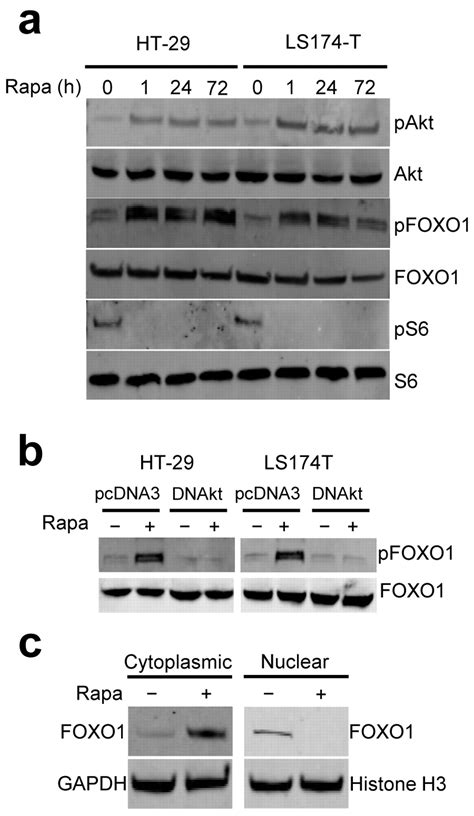 Figure 1 Rapamycin Mediated Foxo1 Inactivation Reduces The