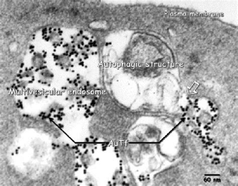 Electron Microscopy Of Reticulocyte Internal Vesicles Labelled With Download Scientific Diagram