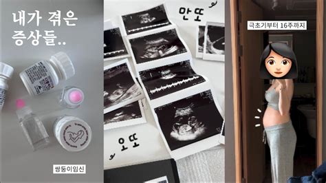 내가 겪었던 임신극초기부터 16주까지 증상들 나만 이런가🙄 입덧약 입덧증상 첫심장소리 태몽 쌍둥이 배 나오는 시기