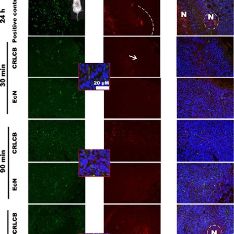 Fluorescence Tracing The Distribution Of Egfp Labeled Bacteria In Tumor