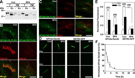 Brefeldin A Causes Resorption Of Cis Golgi Structure To Er But Does Download Scientific