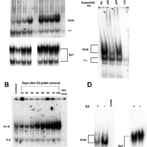E2 Regulates Nf ␬ B Dna Binding In Vitro And In Vivo A Nuclear Download Scientific Diagram