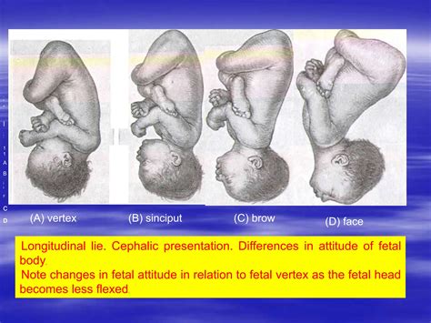 Mechanism Of Labour Normal And Abnormal Ppt