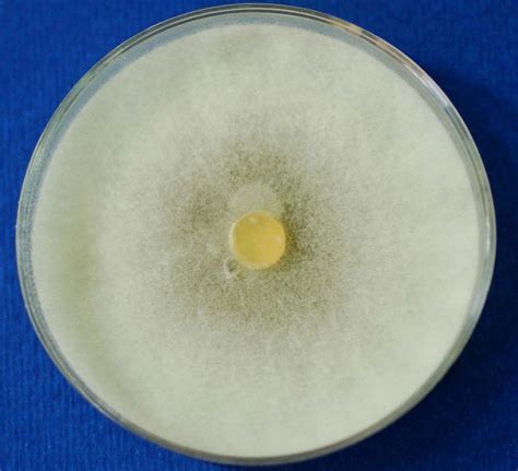 Microbial Based Solutions Trichoderma Salam Med