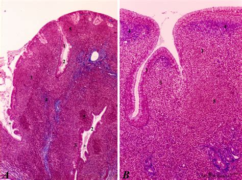 Pharyngeal Tonsil Histology Labeled