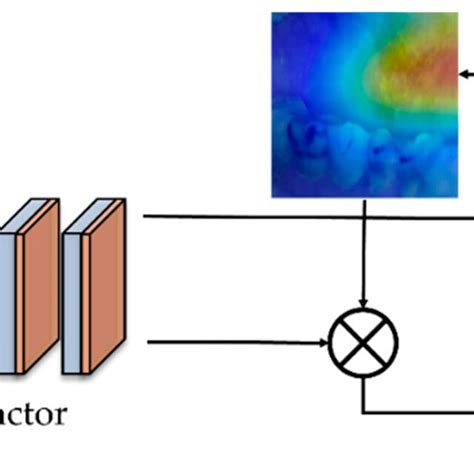 The Block Diagram Of The Attention Branch Network For Our Oral Cancer