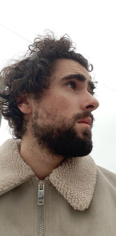 First Time Beard Patchy Cheeks Page 2 Beard Board
