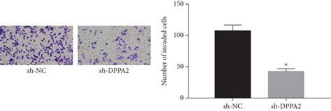 Silencing Dppa2 Hinders Cell Malignant Behaviors In Gastric Cancer