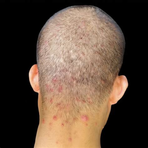 Common Skin Conditions Medi Derm Clinic