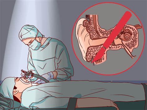 How To Cure Labyrinthitis 14 Steps With Pictures Wikihow