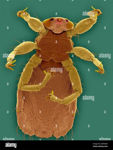 Coloured Scanning Electron Micrograph Sem Of Deer Louse Fly Adult
