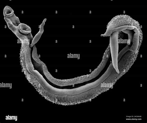 Schistosome Fluke Scanning Electron Micrograph Sem Of A Schistosome