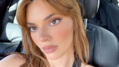 Kendall Jenner Shows Off Very Plump Lips On Instagram