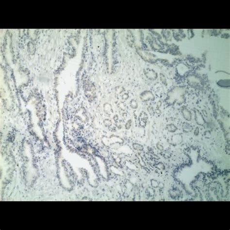 Cil33878 Homo Sapiens Endocrine Paracrine Cell Of Prostate Gland