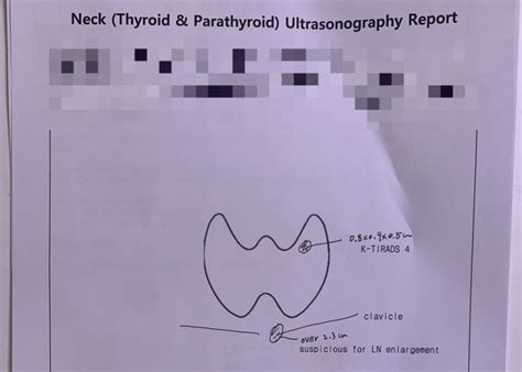 갑상선결절 세침조직검사결과 3단계라고함🤧비정형세포 검사결과 단계별특징 베데스다 시스템 아급성 갑상선염 추후계획 네이버 블로그