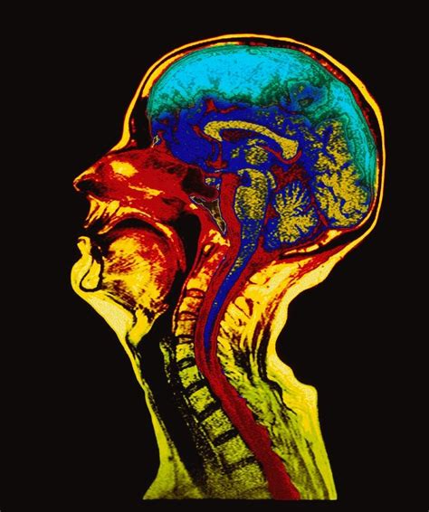 What Is Difference Between Tfe And Tfc In Magneteom Tfe Isotropic