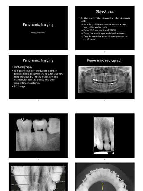 Panoramic Imaging Errors Pdf Panoramic Imaging Errors Pdf