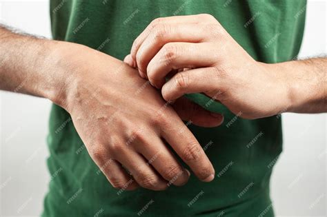 Premium Photo Skin Itching Skin Disease Skin Rashes Allergy