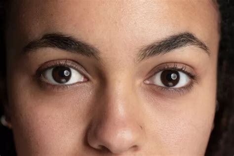 Bukan Cuma Kurang Tidur Ini 4 Penyebab Kantung Mata Hitam Yang Perlu