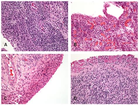 Synovial Membrane Histology