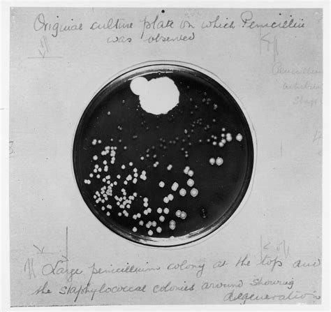 Safely Evaluating Penicillin Allergy With 2 Step Graded Oral Challenge