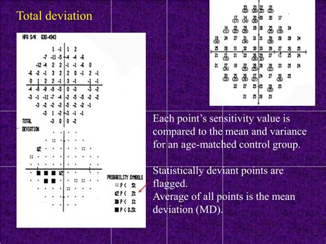 Ppt Automated Perimetry Or What Do All Those Dots And Numbers Mean Powerpoint