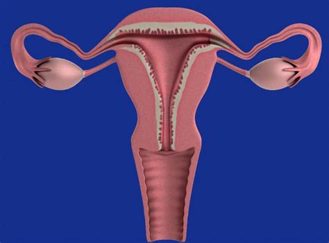 Miomas uterinos Qué son síntomas diagnóstico tratamiento tipos