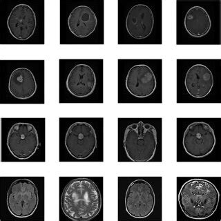 Examples Of Brain Tumor Samples From The Datasets Download Scientific Diagram