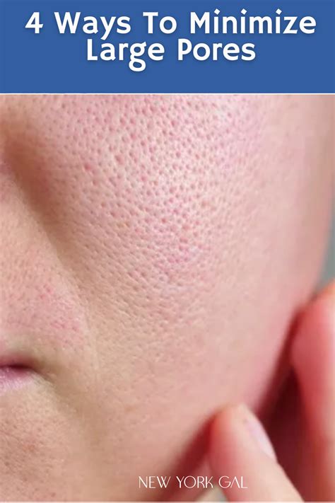 4 Ways To Minimize Large Pores New York Gal Large Pores How To
