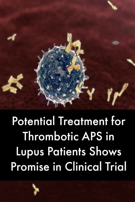 1000 Images About Lupus News Today On Pinterest