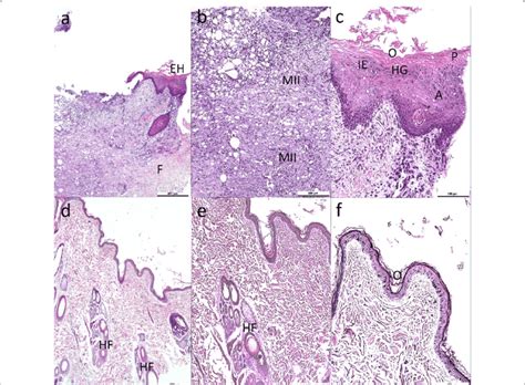 Histological Sections Of Skin Wounds Biopsies After 7 Days Of